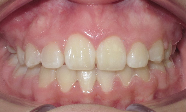 Digital Orthodontic Consultation | Kids Mile High | Denver, CO